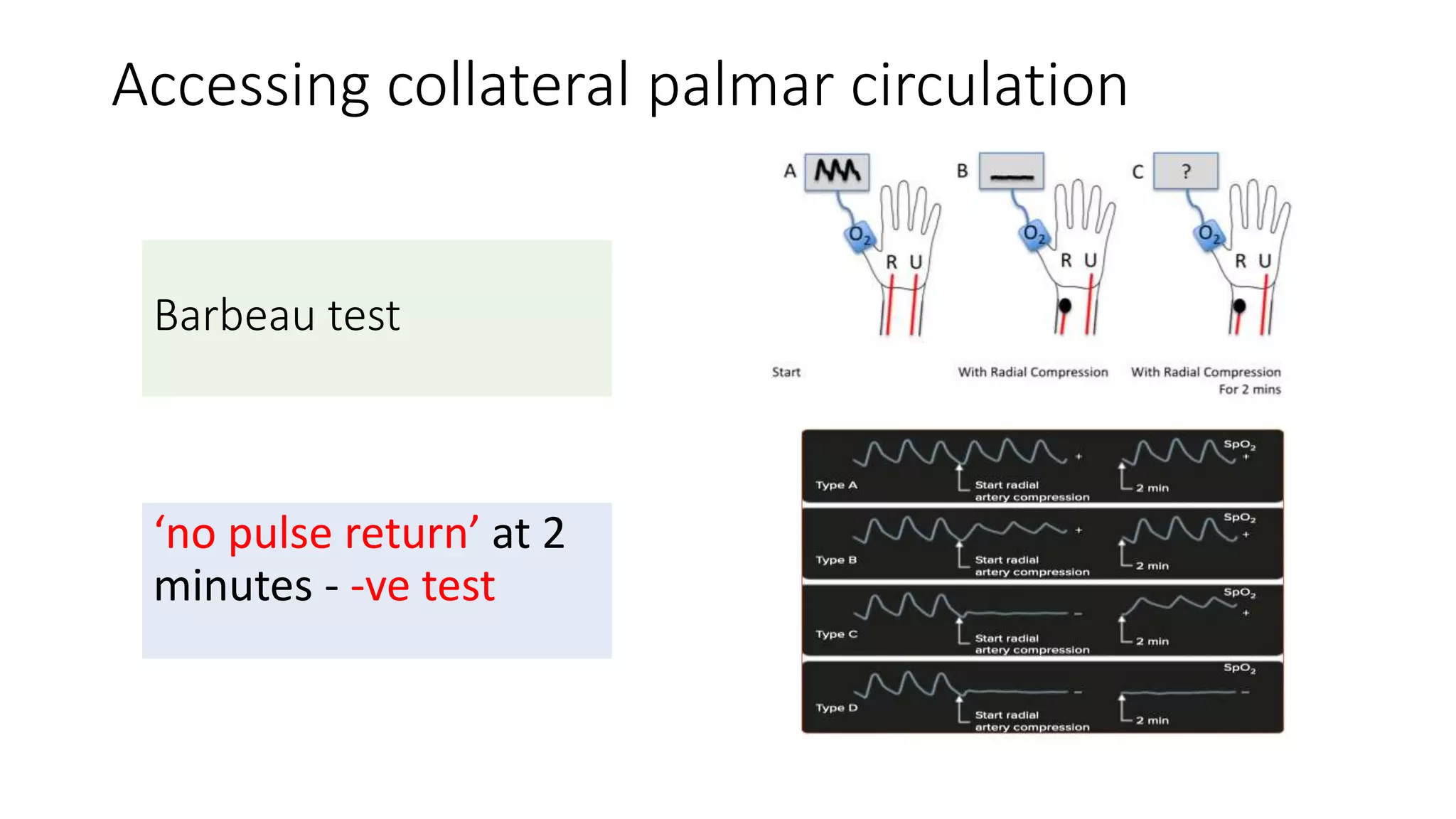 Radial Access ISVIR.pptx