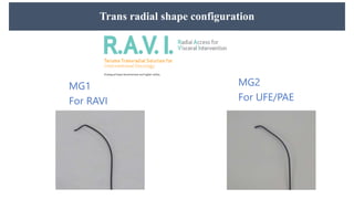 Radial Access ISVIR.pptx