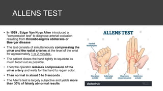 Radial artery access ,complications and magement | PPTX