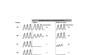 Radial artery access ,complications and magement | PPTX