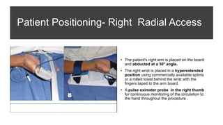 Radial artery access ,complications and magement | PPTX