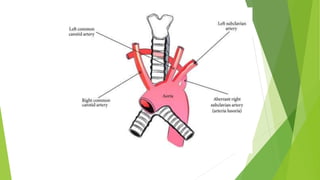 Radial artery access[1] | PPTX