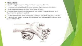 Radial artery access[1] | PPTX