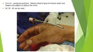 Radial artery access[1] | PPTX