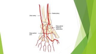 Radial artery access[1] | PPTX