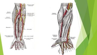 Radial artery access[1] | PPTX