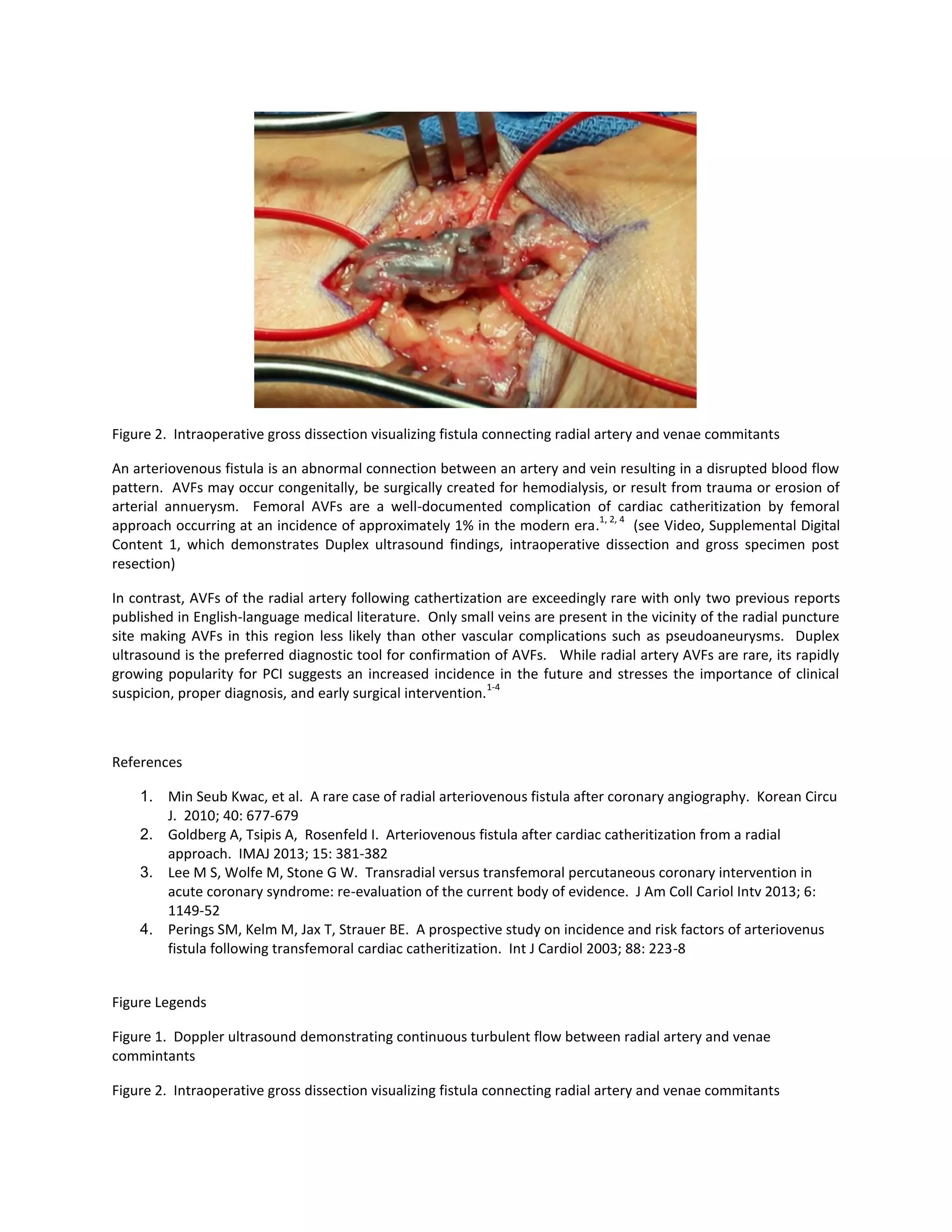 Radial ArterioVenous Fistula with pictures | PDF