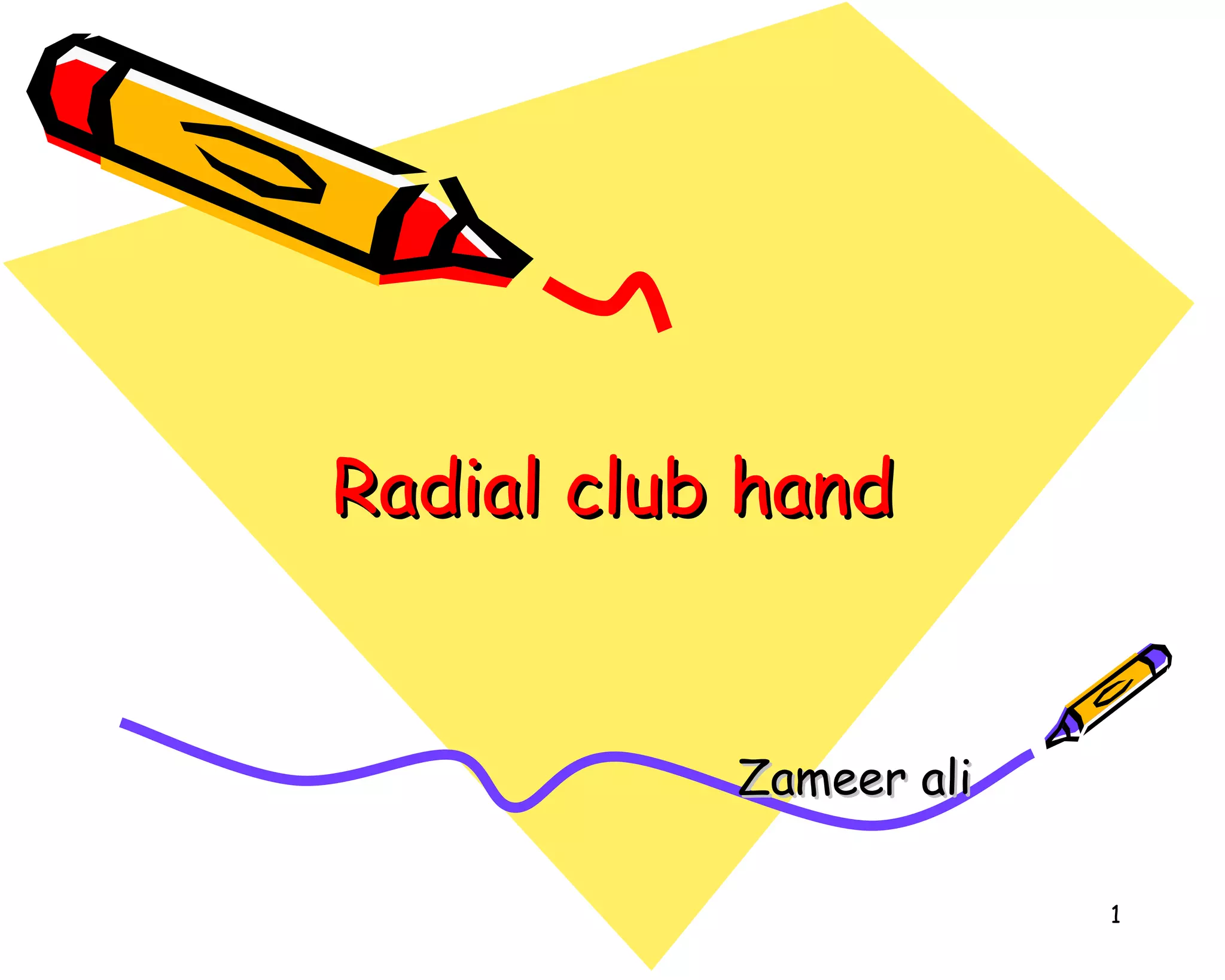 Radial club hand | PPT