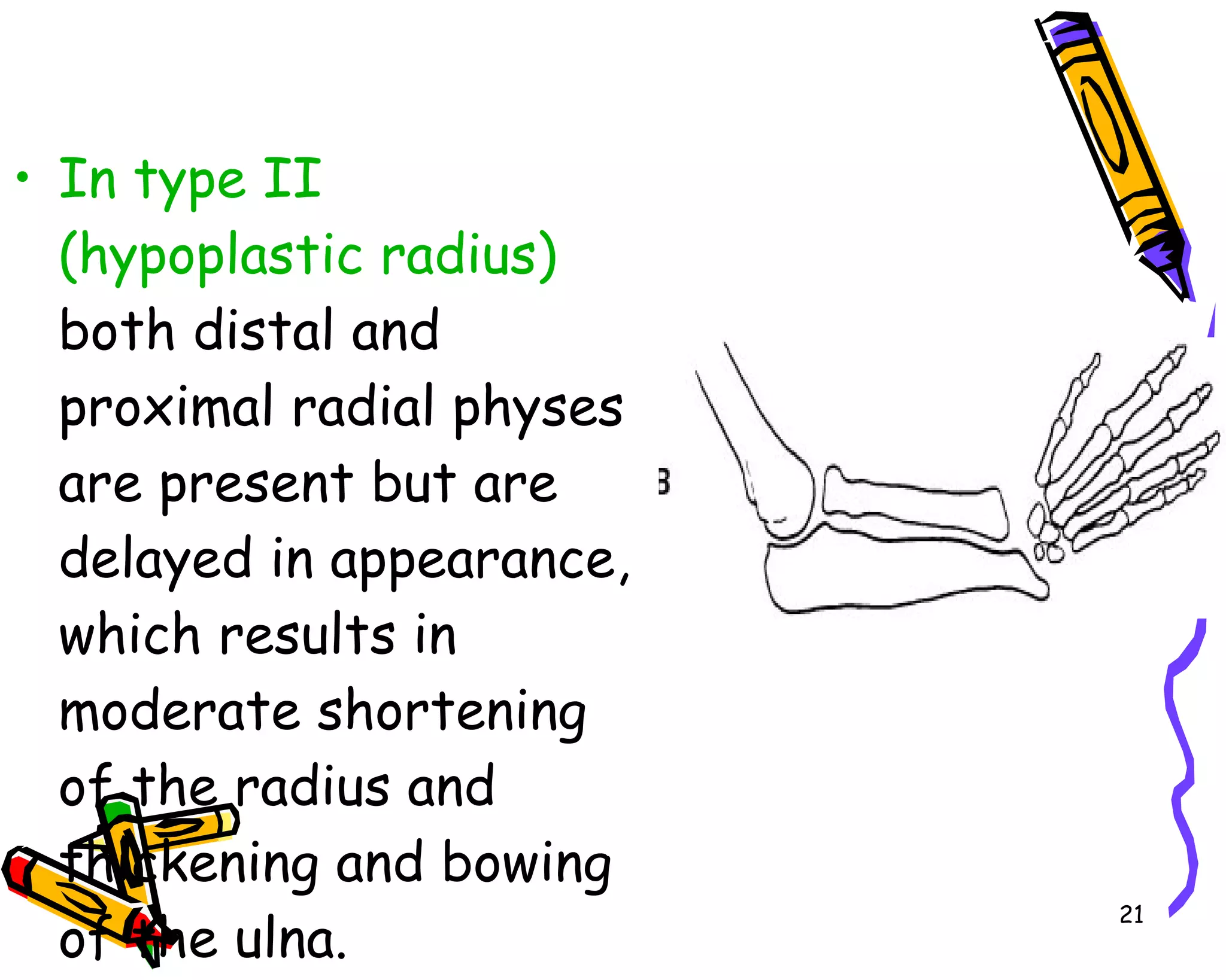 Radial club hand | PPT
