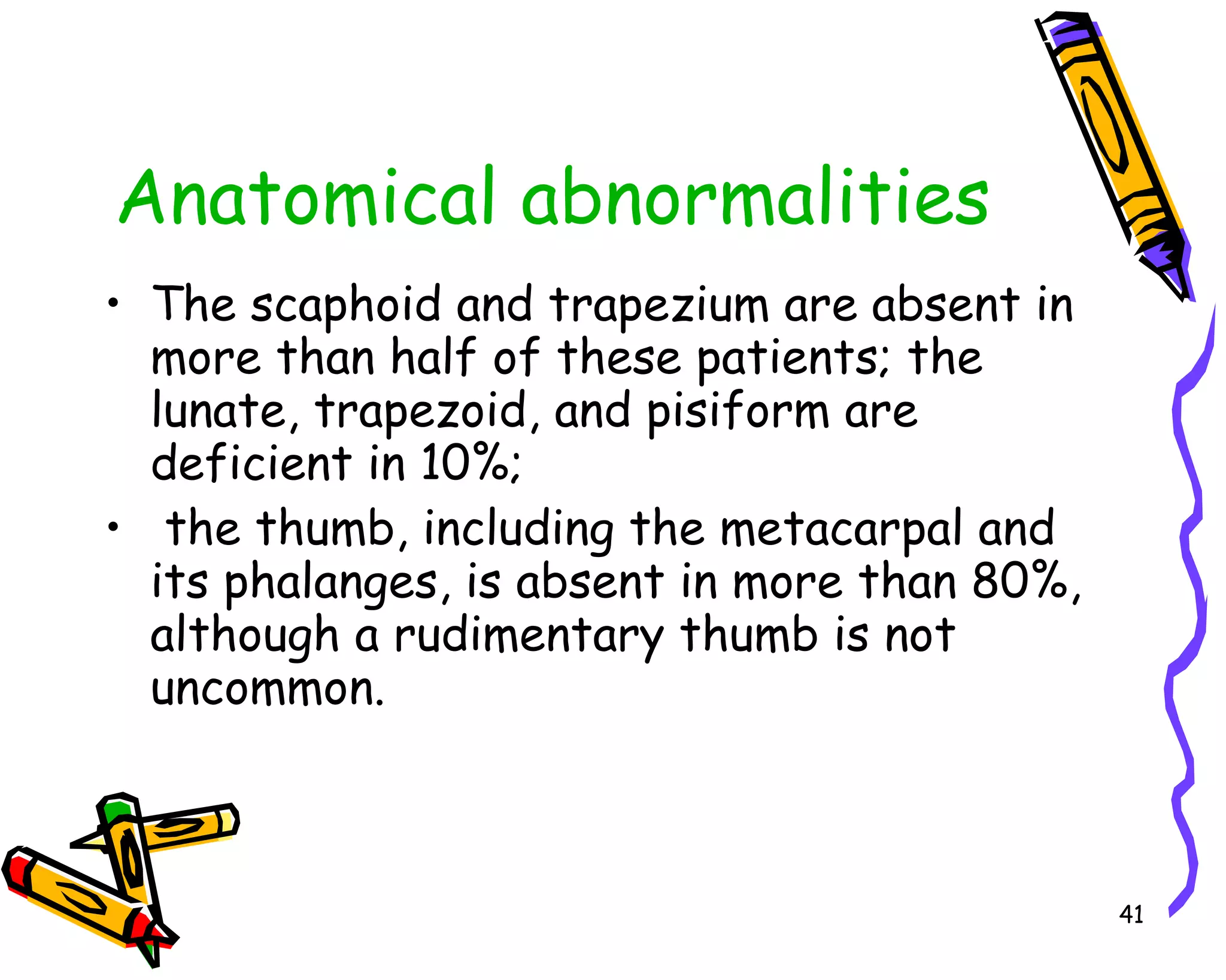 Radial club hand | PPT | Death, Injury, or Military Conflict ...