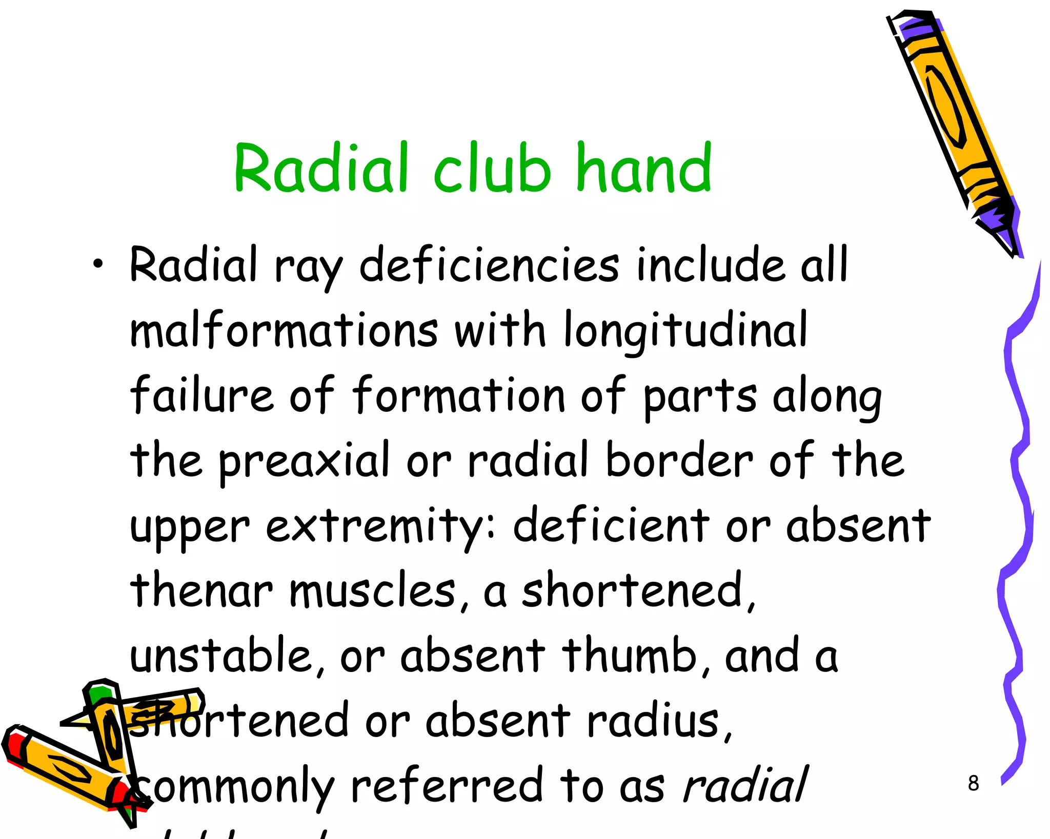 Radial club hand | PPT