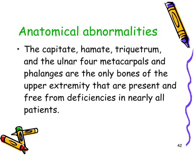 Radial club hand | PPT | Death, Injury, or Military Conflict ...