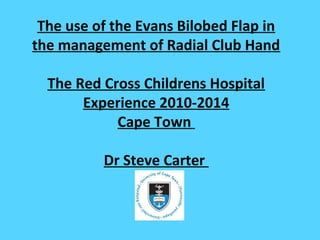 Radial Club Hand | PPT