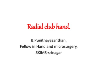 Radial club hand | PPTX