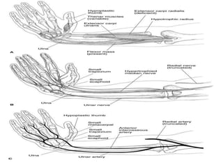 Radial club hand | PPTX