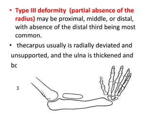 Radial club hand | PPTX