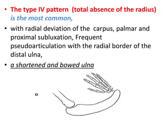 Radial club hand | PPTX