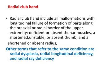 Radial club hand | PPTX