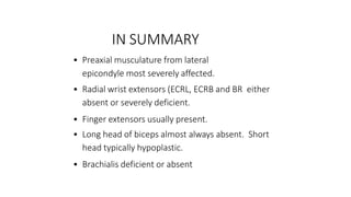 Radial club hand (Radial Dysplasia) | PPTX