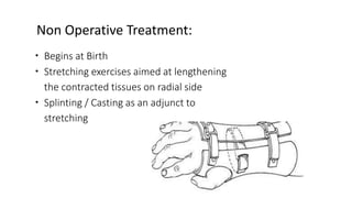 Radial club hand (Radial Dysplasia) | PPTX
