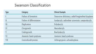 Radial club hand (Radial Dysplasia) | PPTX