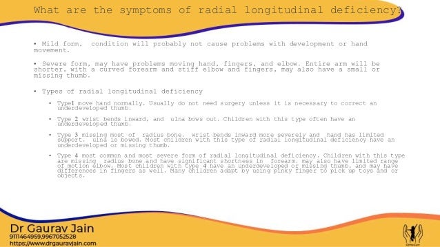 Radial club hand : Rare but treatable condition | PPTX