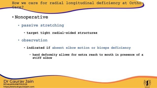 Radial club hand : Rare but treatable condition | PPTX