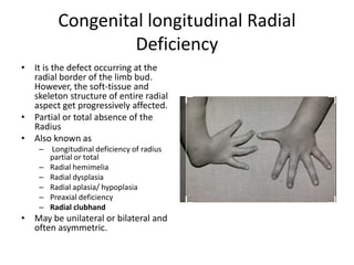Radial Deficiency and Management.pptx