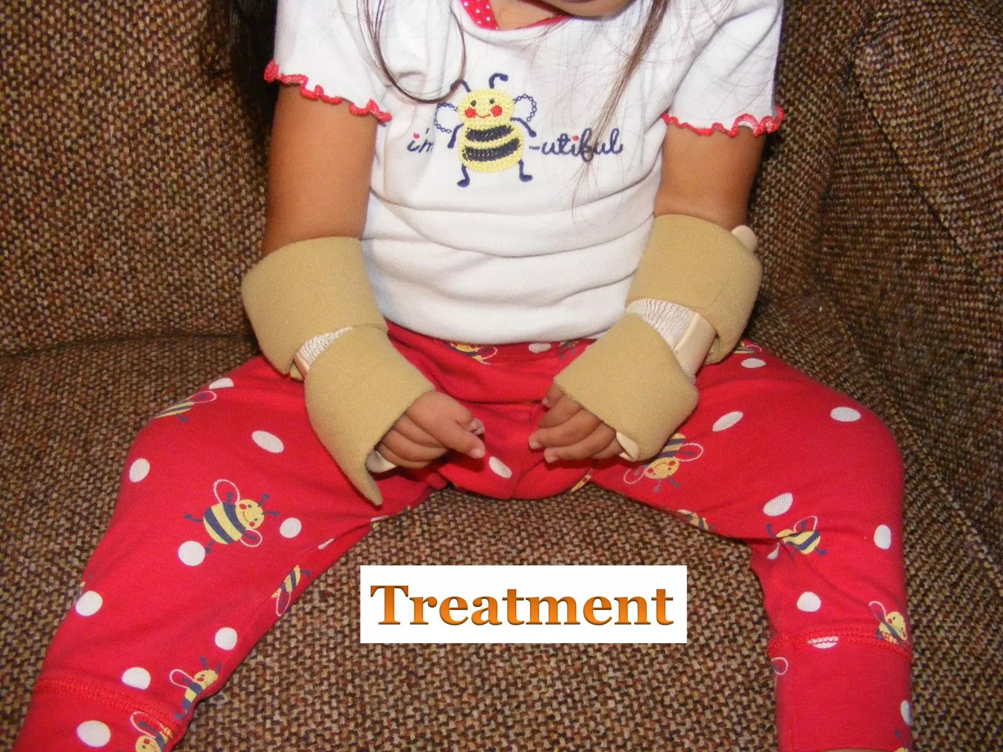 Radial Dysplasia By Kids Orthopedic | PPT