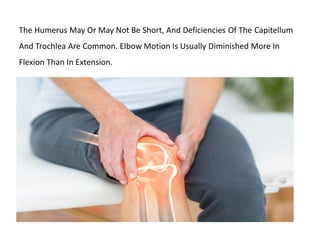 Radial Dysplasia By Kids Orthopedic | PPT