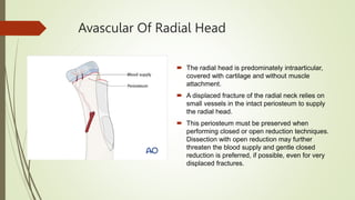 Radial Head Excision technique Operation .pptx