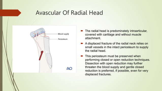 Radial Head Excision technique Operation .pptx | First Aid | Injuries