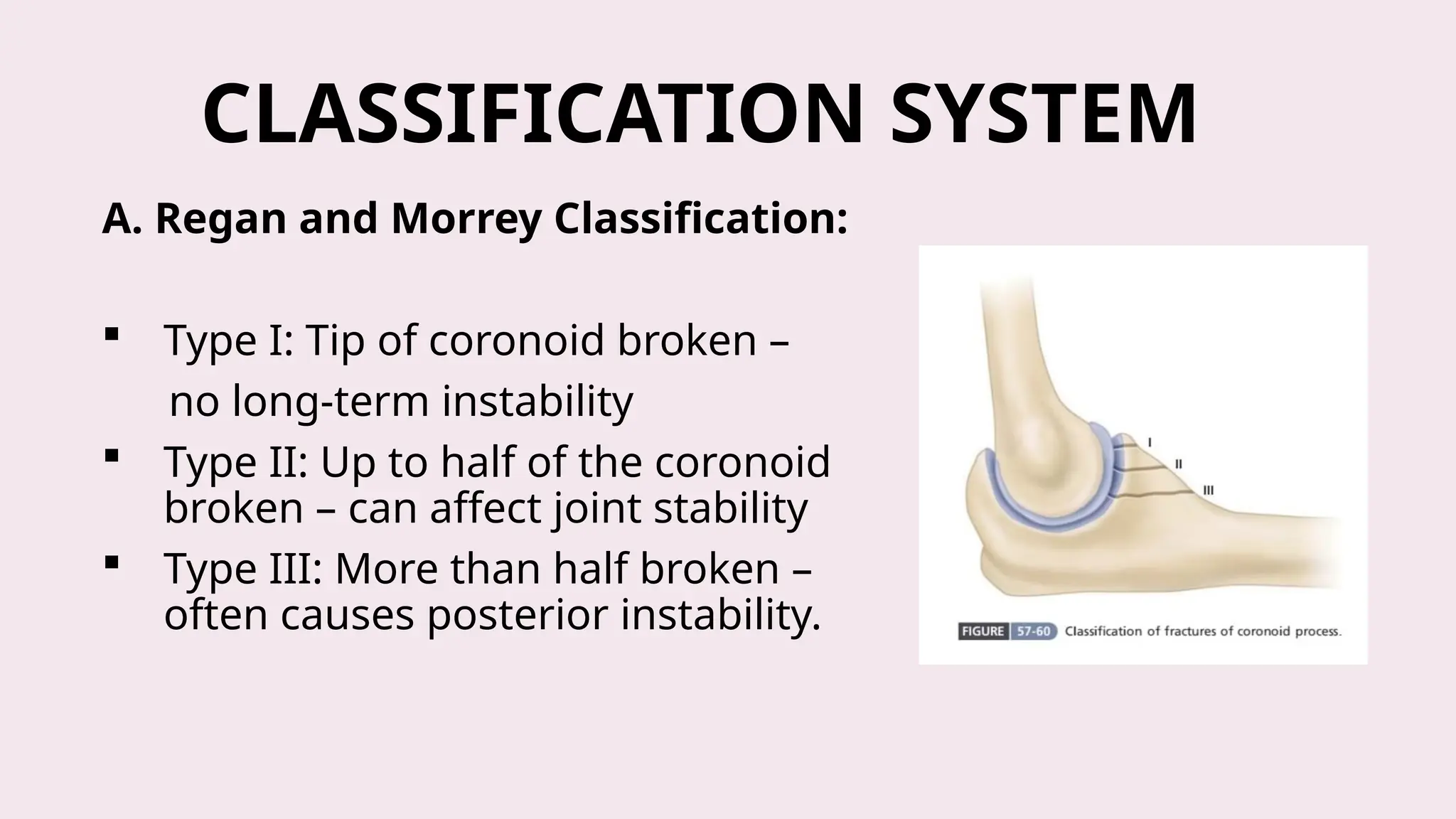 Powerpoint presentation on Radial Head and Neck Fractures | PPT