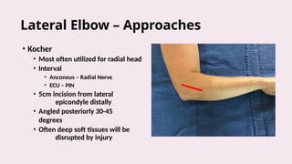 Radial Head and Neck Fractures powerpoint | PPTX