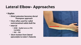 Radial Head and Neck Fractures powerpoint | PPTX