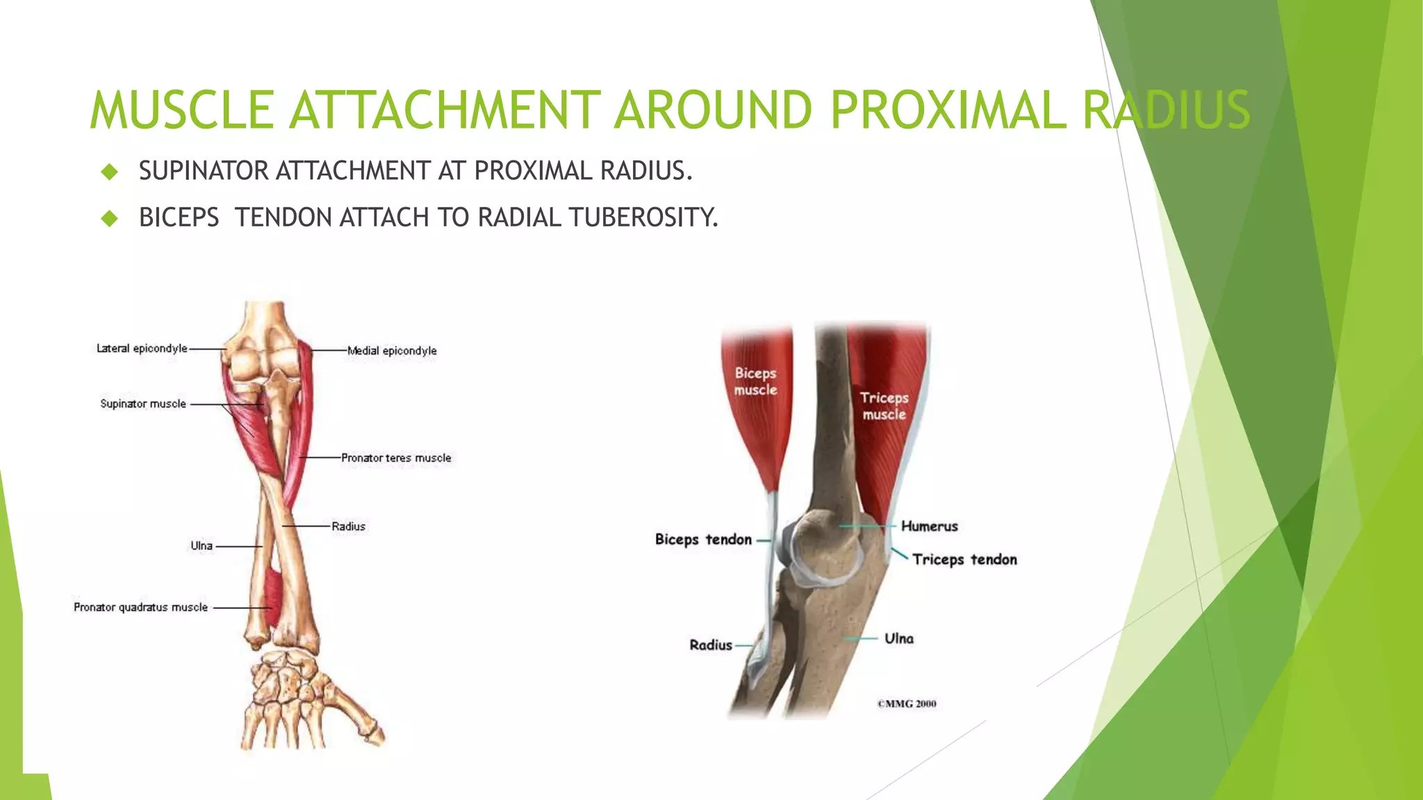 Radial head fracture | PPTX