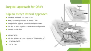 Radial head fracture | PPTX