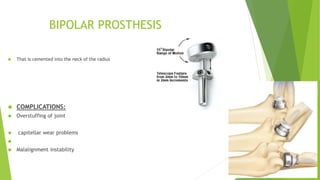 Radial head fracture | PPTX