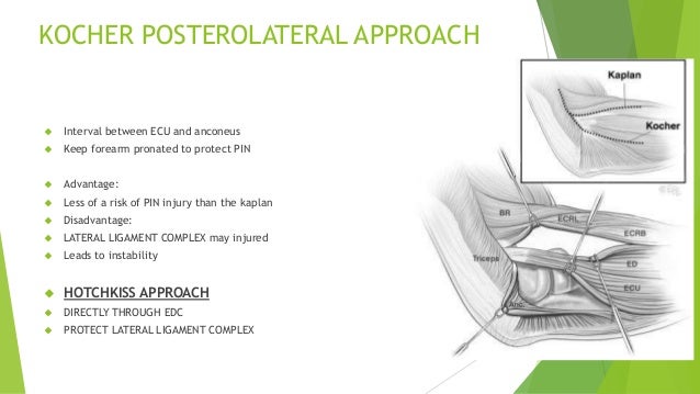 Radial head fracture