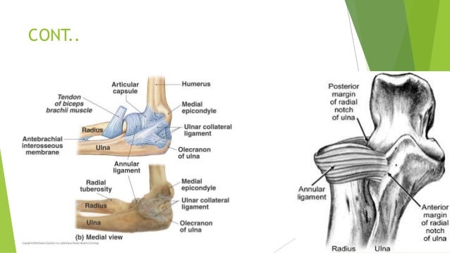 Radial head fracture