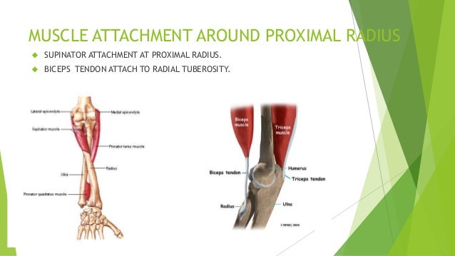 Radial head fracture