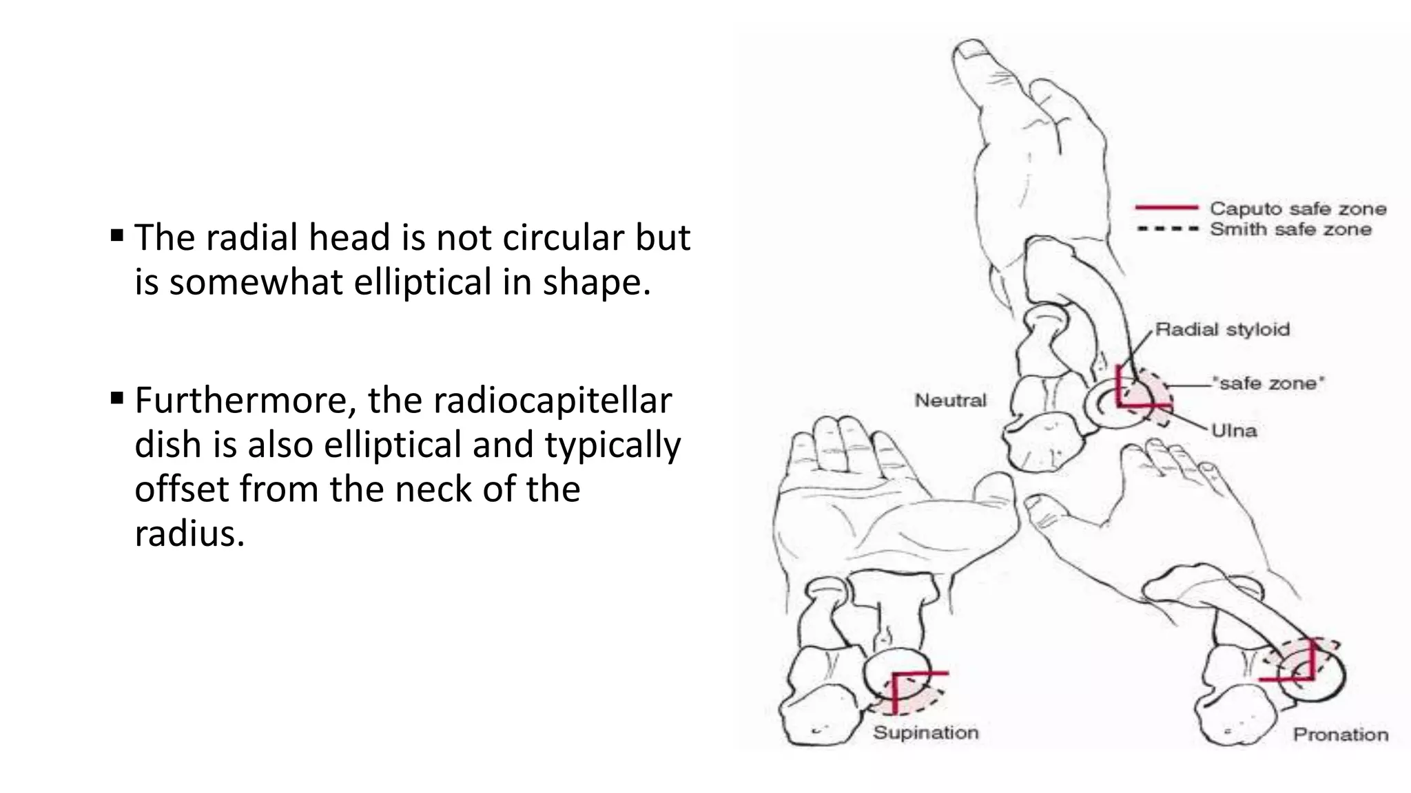 Radial head fracture | PPTX