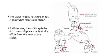 Radial head fracture | PPTX
