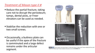 Radial head fracture | PPTX