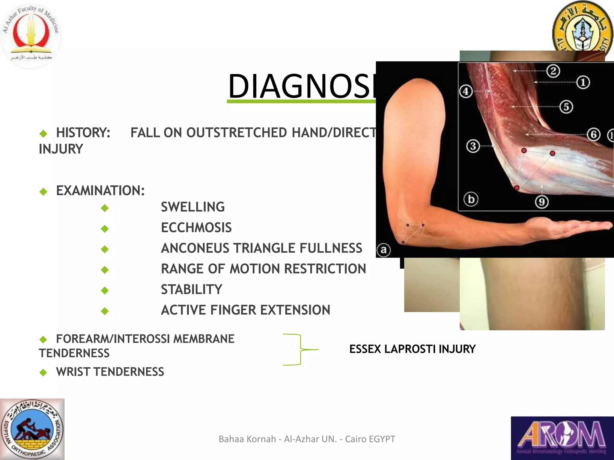 Radial head fracture | PPT
