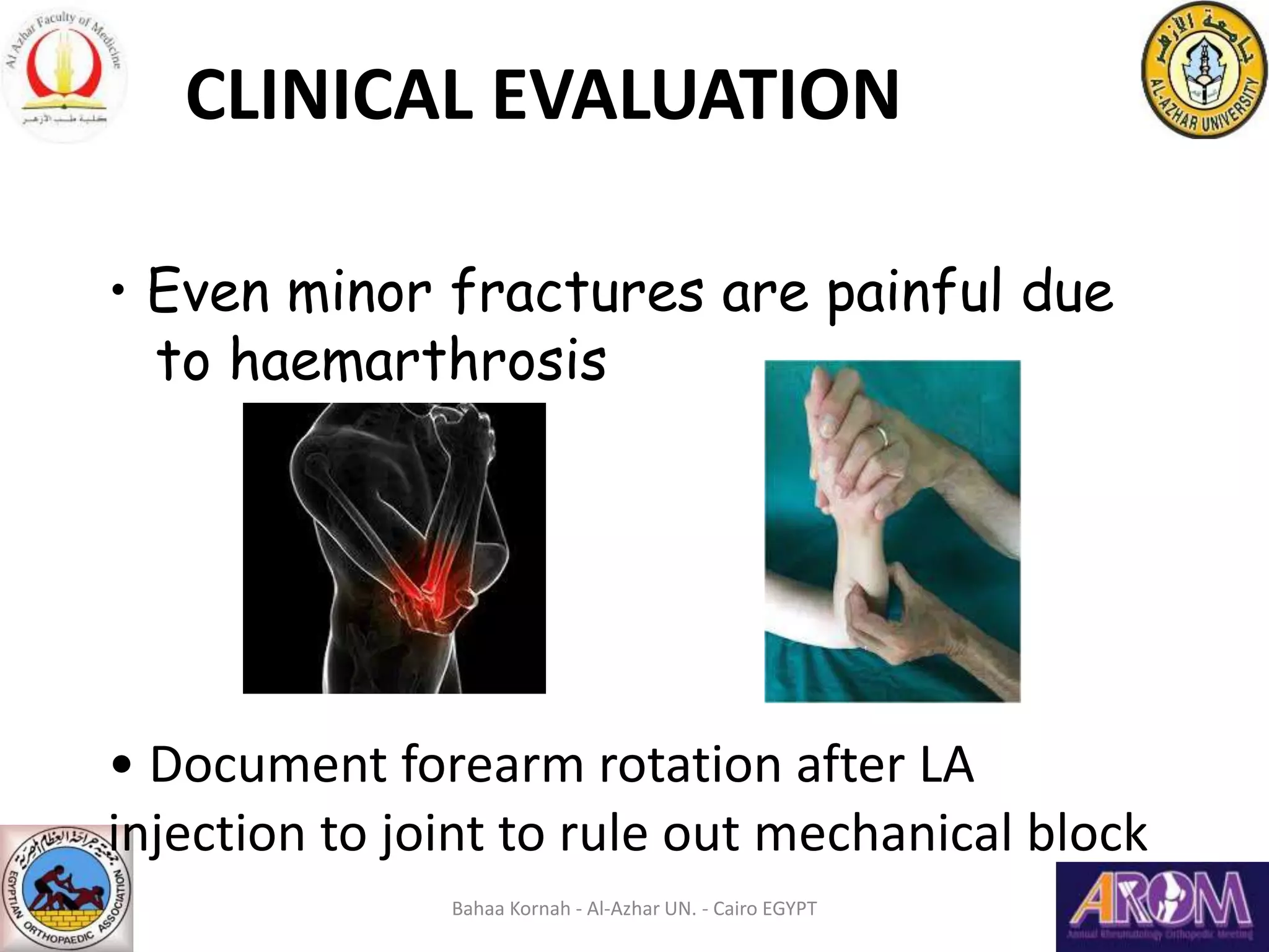 Radial head fracture | PPT