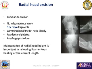 Radial head fracture | PPT