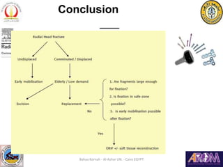 Radial head fracture | PPT