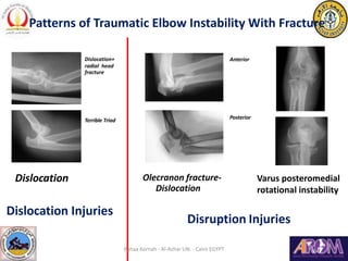 Radial head fracture | PPT