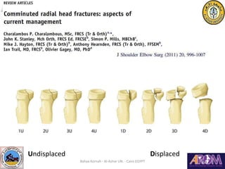 Radial head fracture | PPT